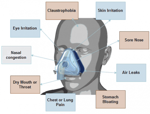 Managing CPAP Side Effects | CPAP Maintenance | Irish CPAP Experts